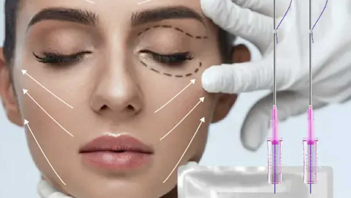 Tampa PDO Threads: Lift and Rejuvenate | Skin NV